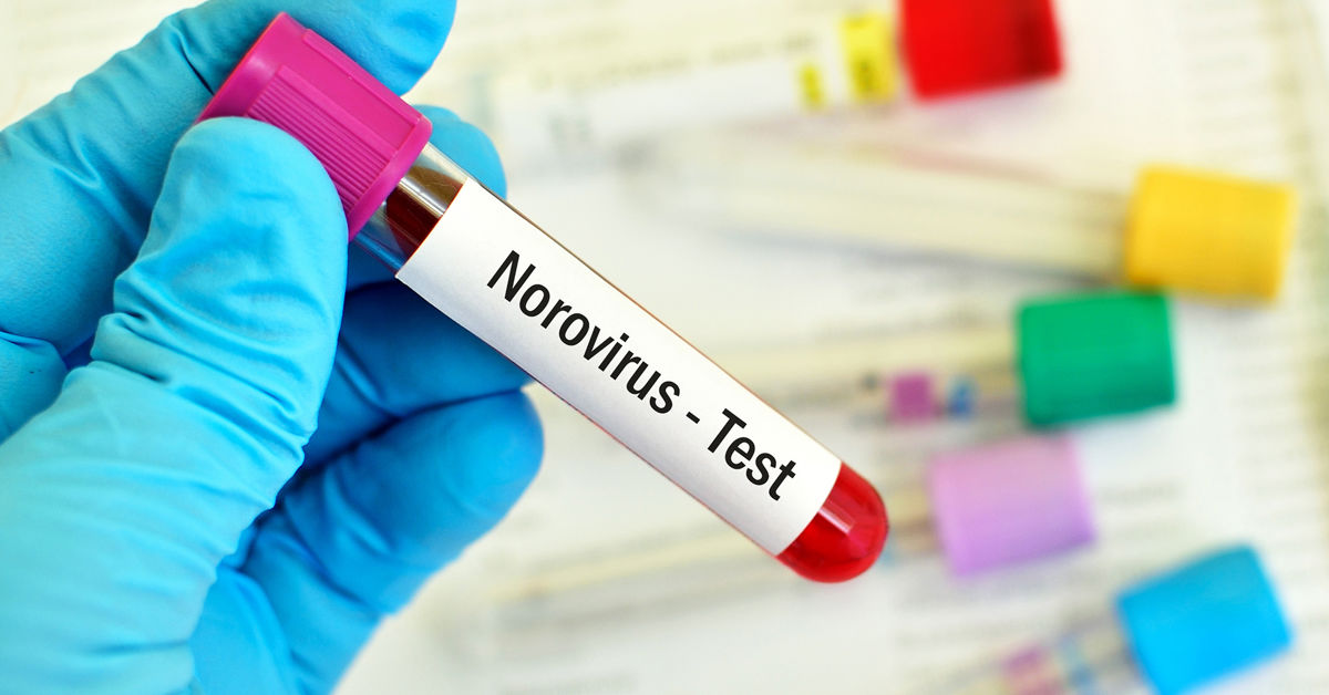 Utbrudd av norovirus - Sykehuset Telemark HF